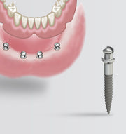 Dentatus